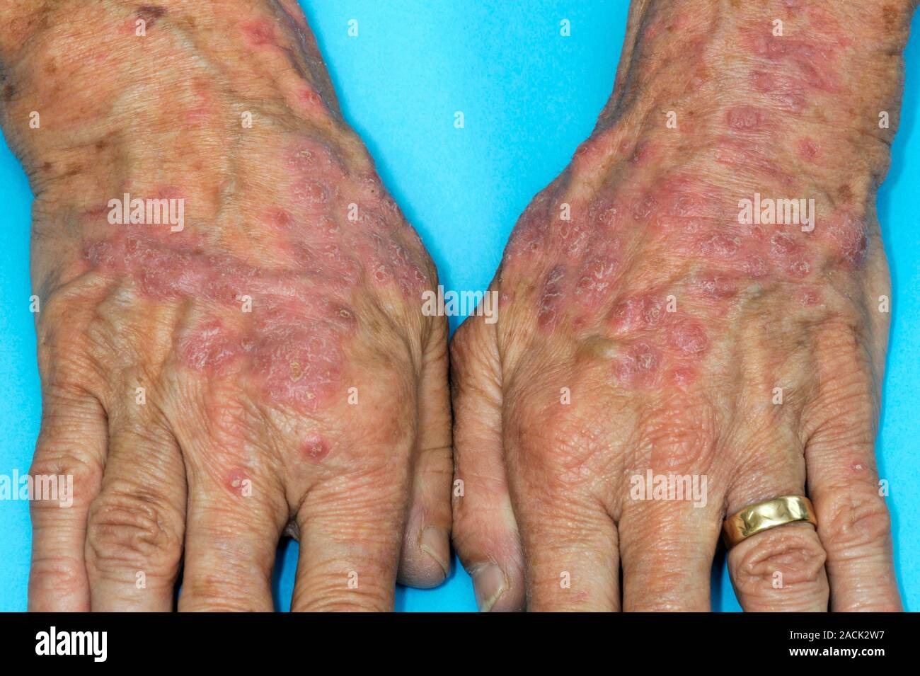 Not for use in Television Not for use in Television Close-up of the ...