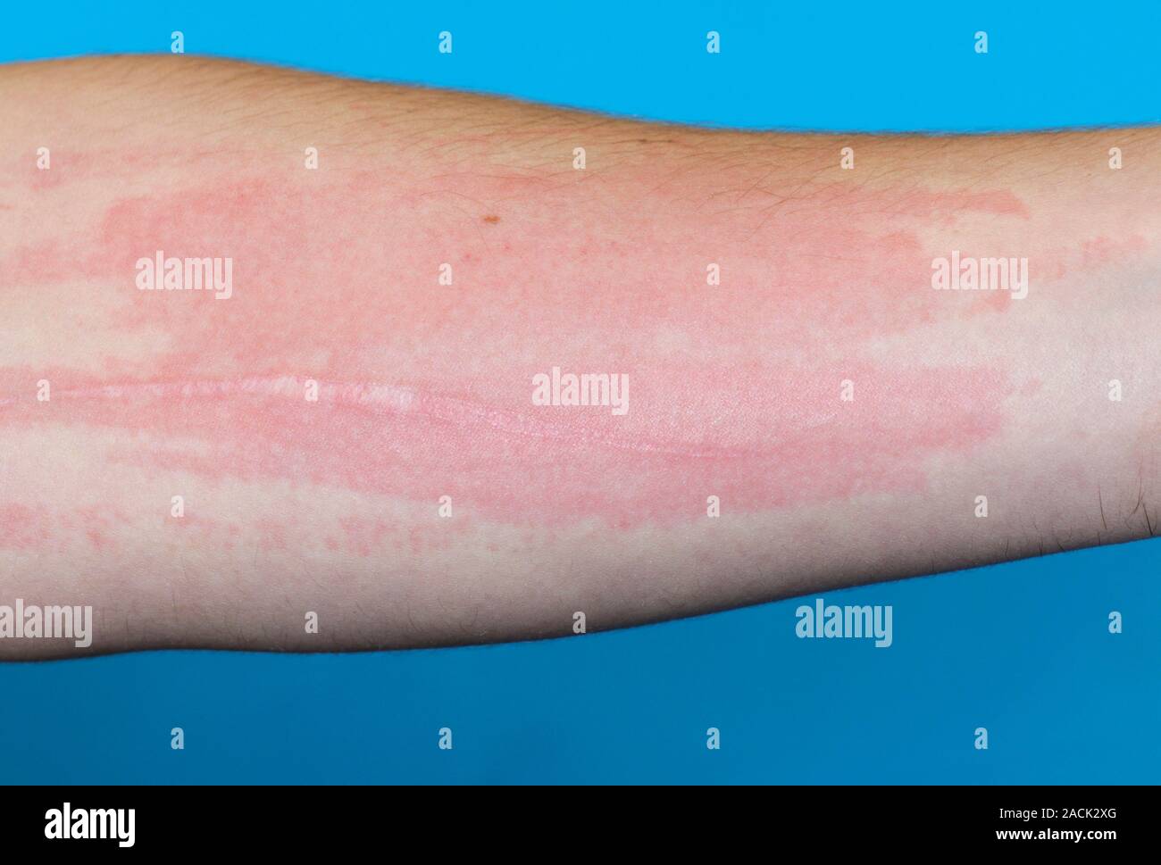 Not for use in Television Not for use in Television Wheal and flare ...