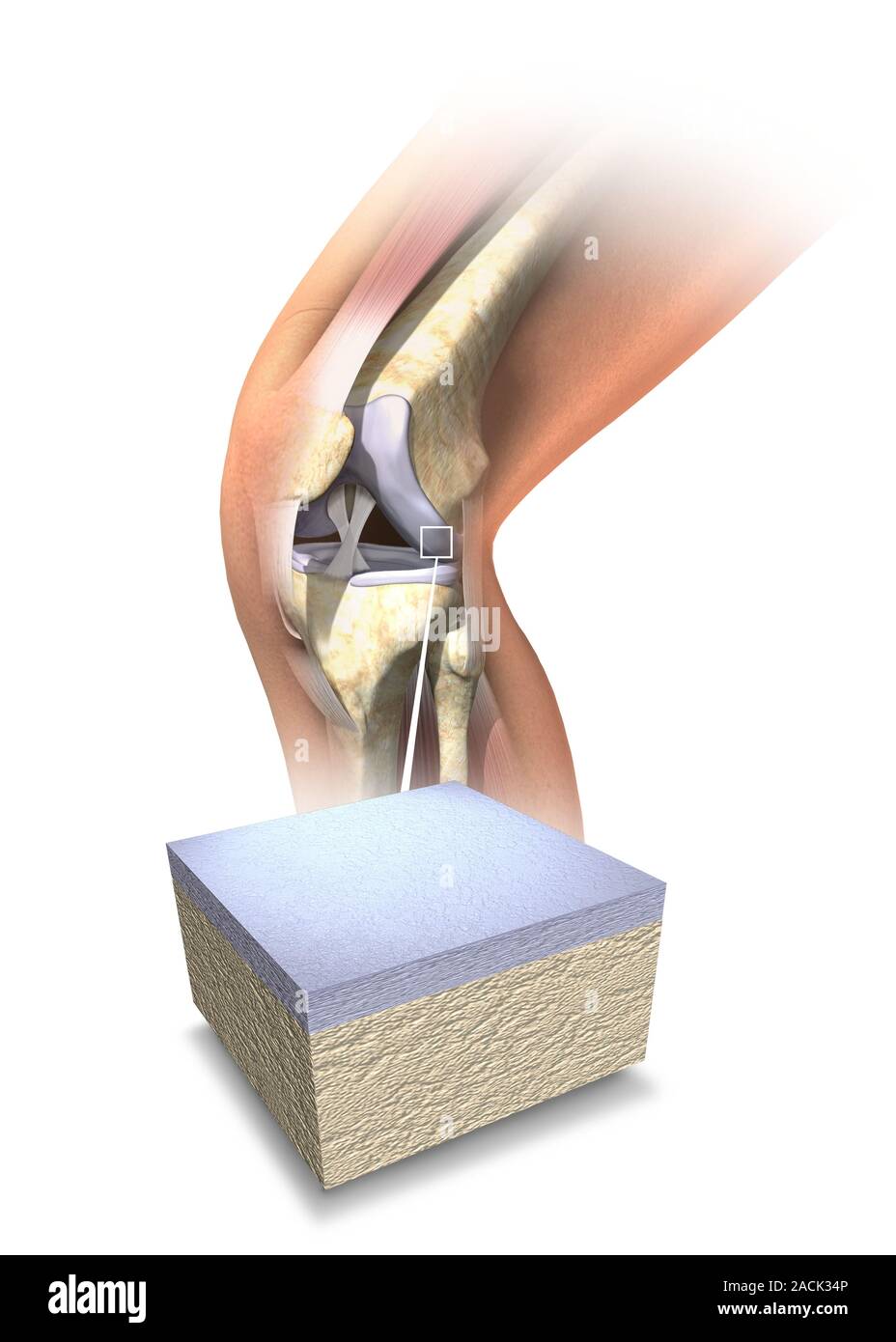 Normal human knee. Artwork showing the internal anatomy of a healthy ...