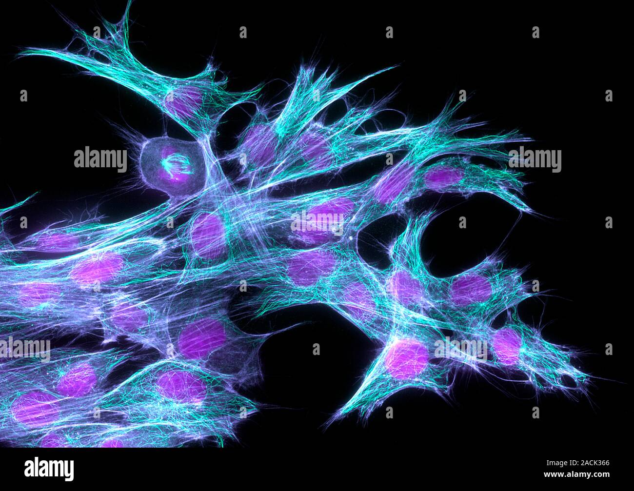 Fibroblast cells. Immunofluorescence light micrograph of fibroblast ...