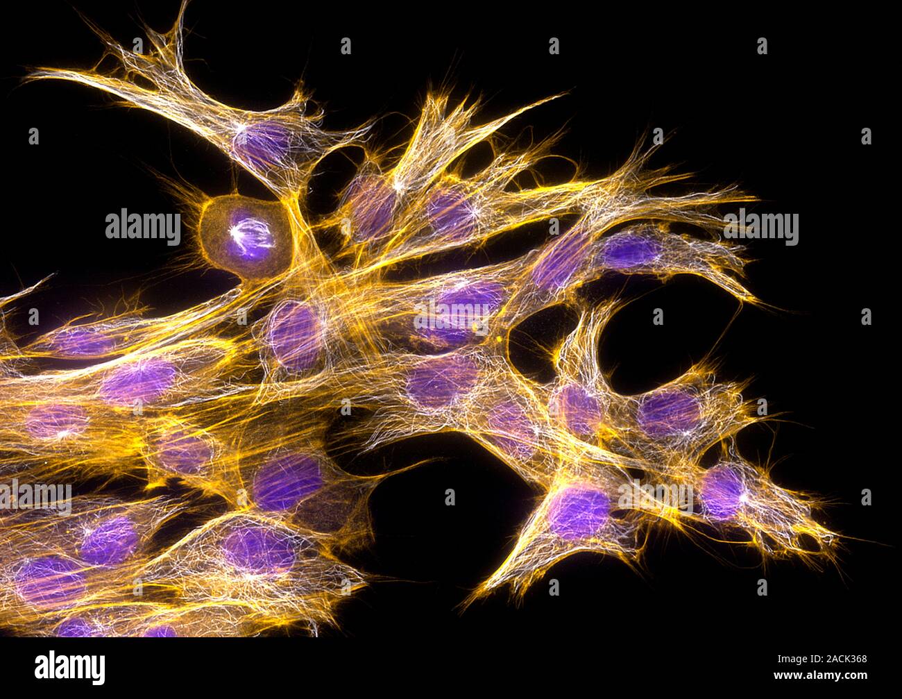 Fibroblast cells. Immunofluorescence light micrograph of fibroblast cells. The cell nuclei are ...