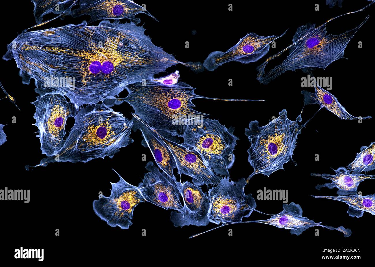 Lung cells. Immunofluorescence light micrograph of pulmonary ...