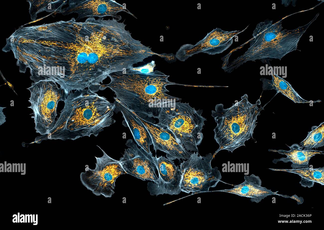 Lung cells. Immunofluorescence light micrograph of pulmonary ...