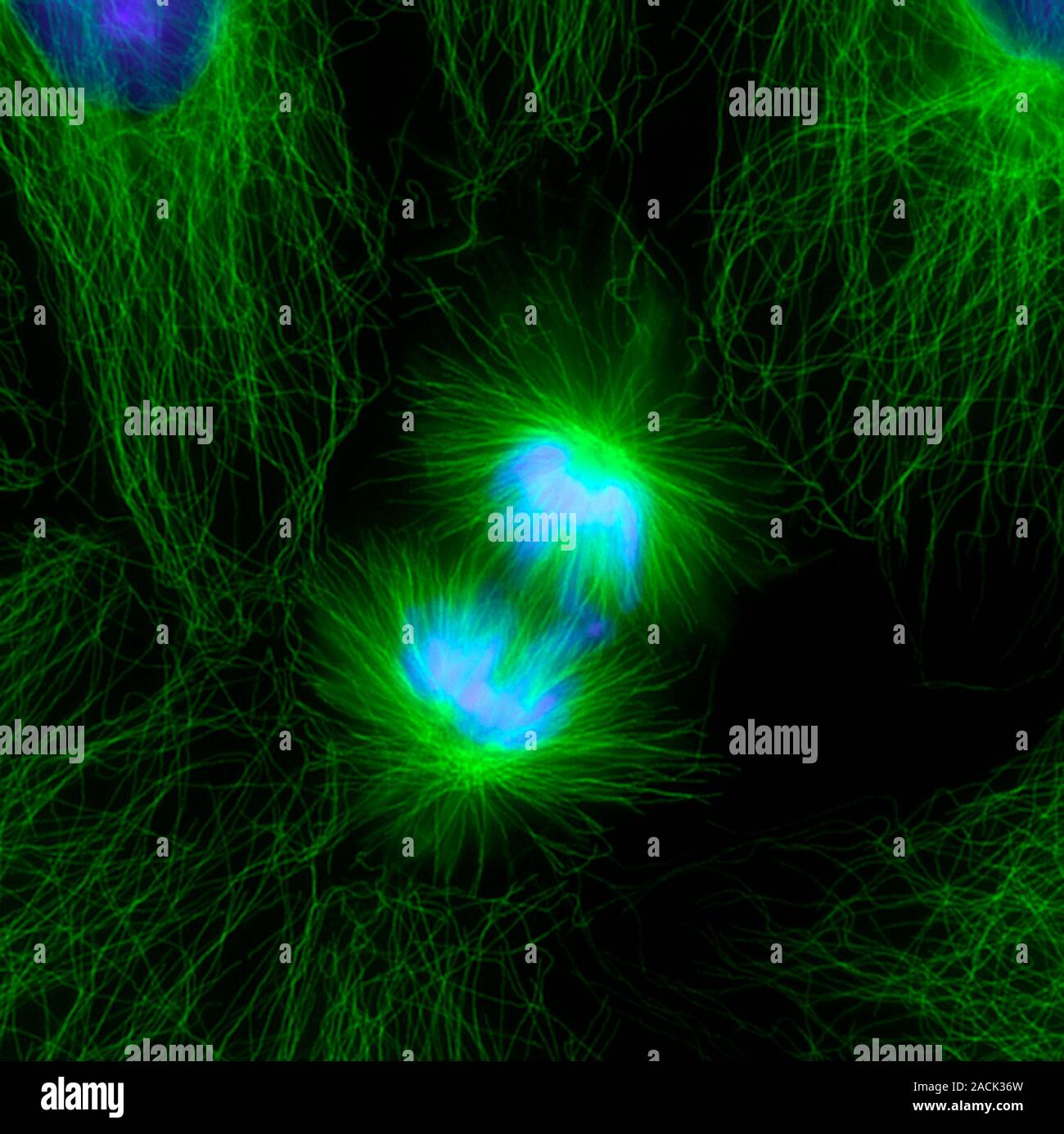 Cell division. Immunofluorescent light micrograph of a human epithelial ...