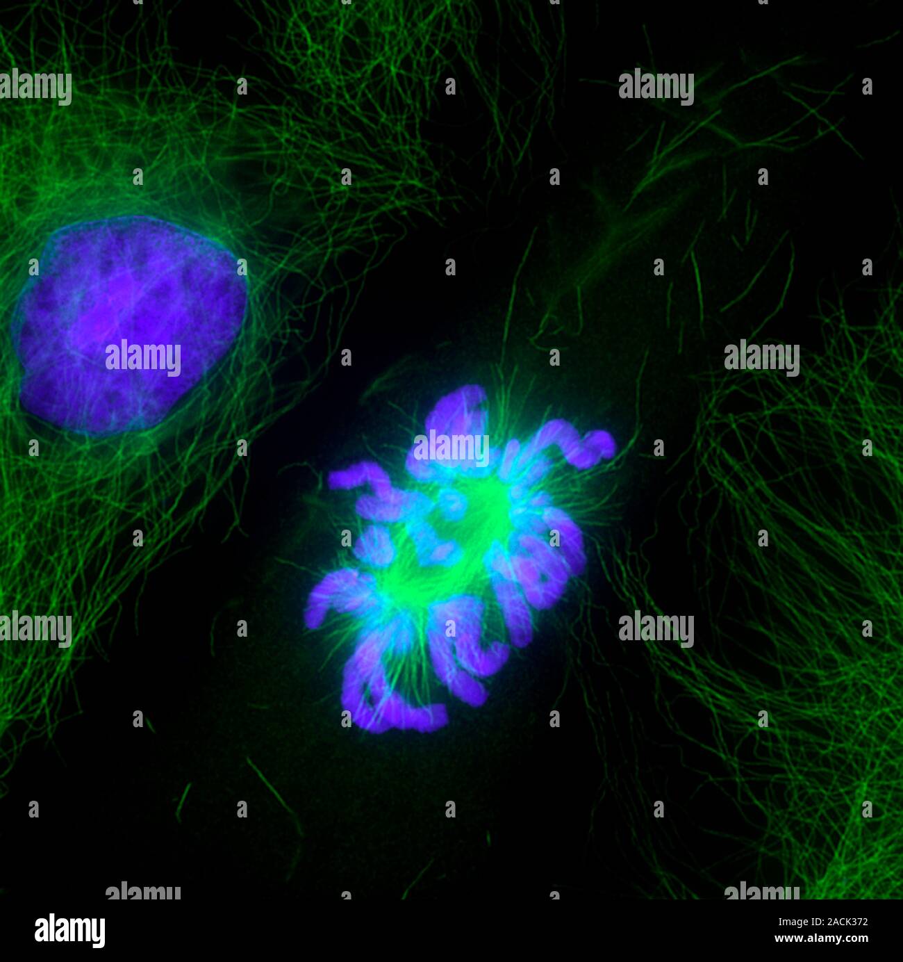 Cell division. Immunofluorescent light micrograph of a human epithelial ...