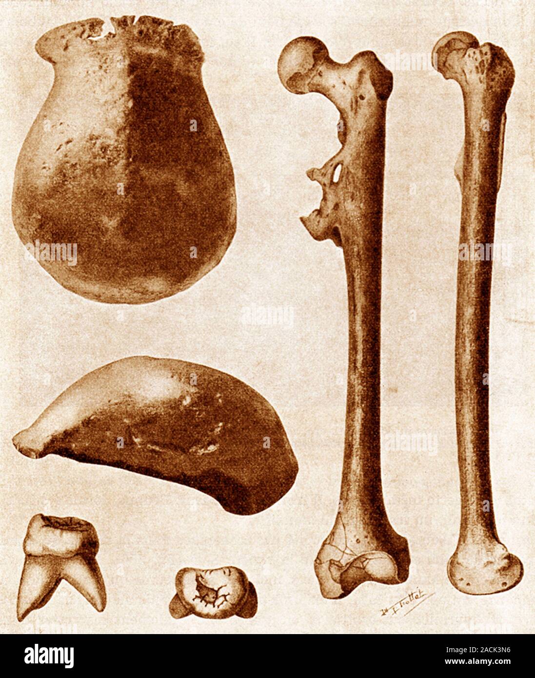 Java Man bones, artwork. Historical sketch of the fossilised remains of ...