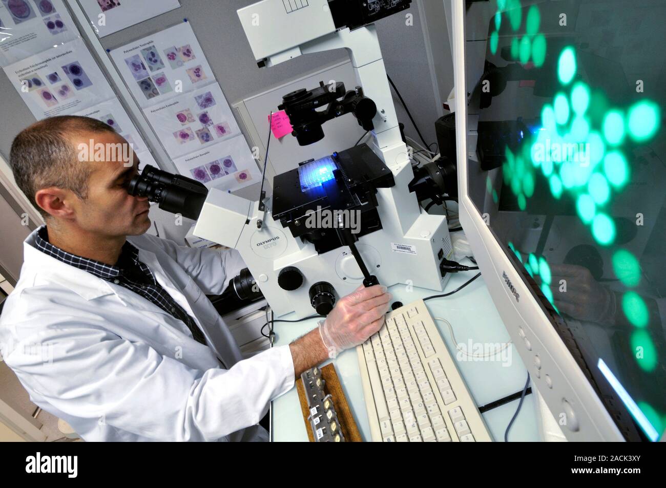 Blood type modification. Modified blood cells being viewed under a ...