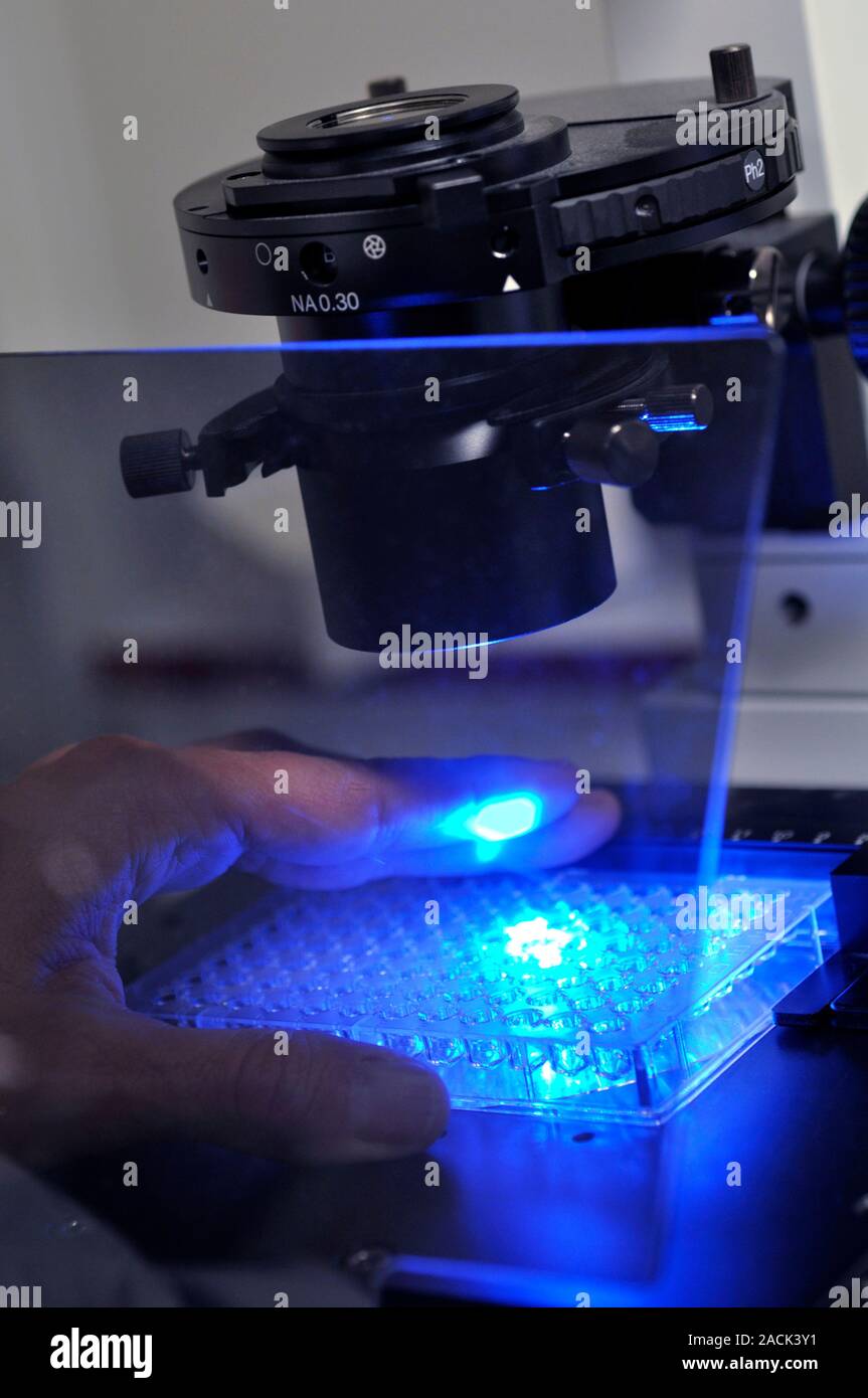Blood type modification. Modified blood cells being viewed under a ...