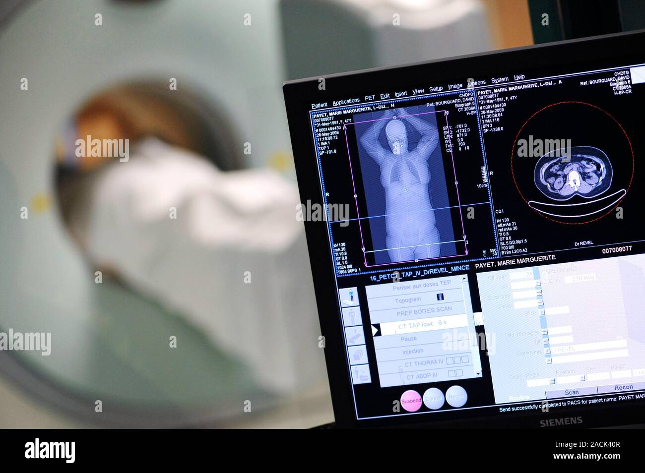 MRI scan. Close-up of the screen showing a patient undergoing an MRI ...