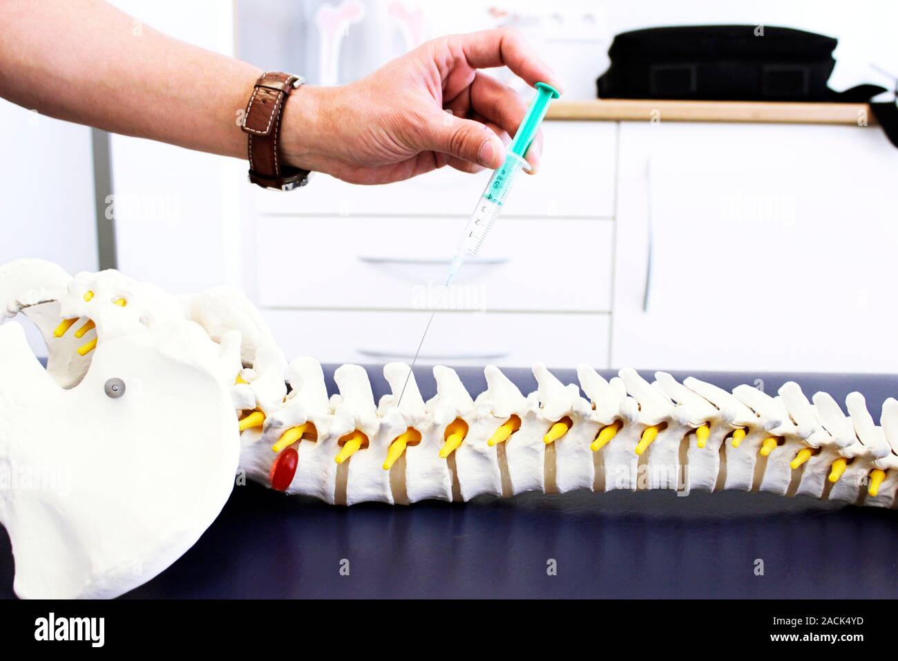 Orthopaedics. Orthopaedic surgeon using a model of the human spine to ...