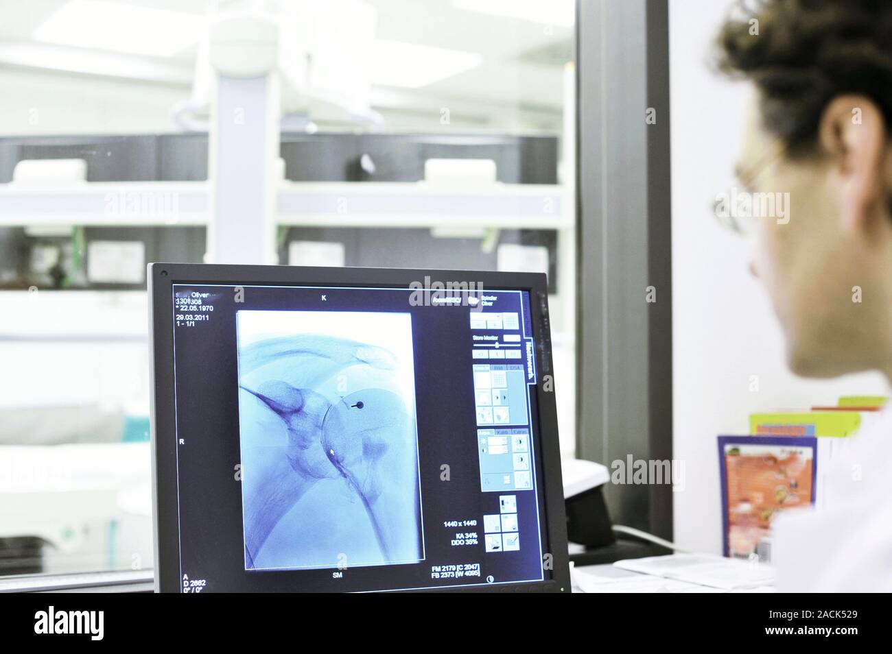 CT scan. Radiologist viewing the results of a patient's computed ...