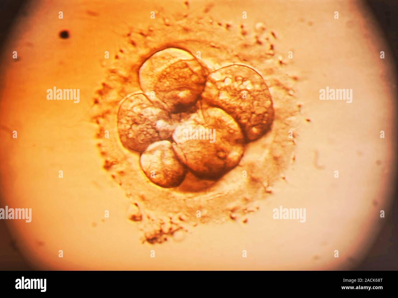 IVF embryo. Coloured light micrograph of a human embryo 48-72 hours ...