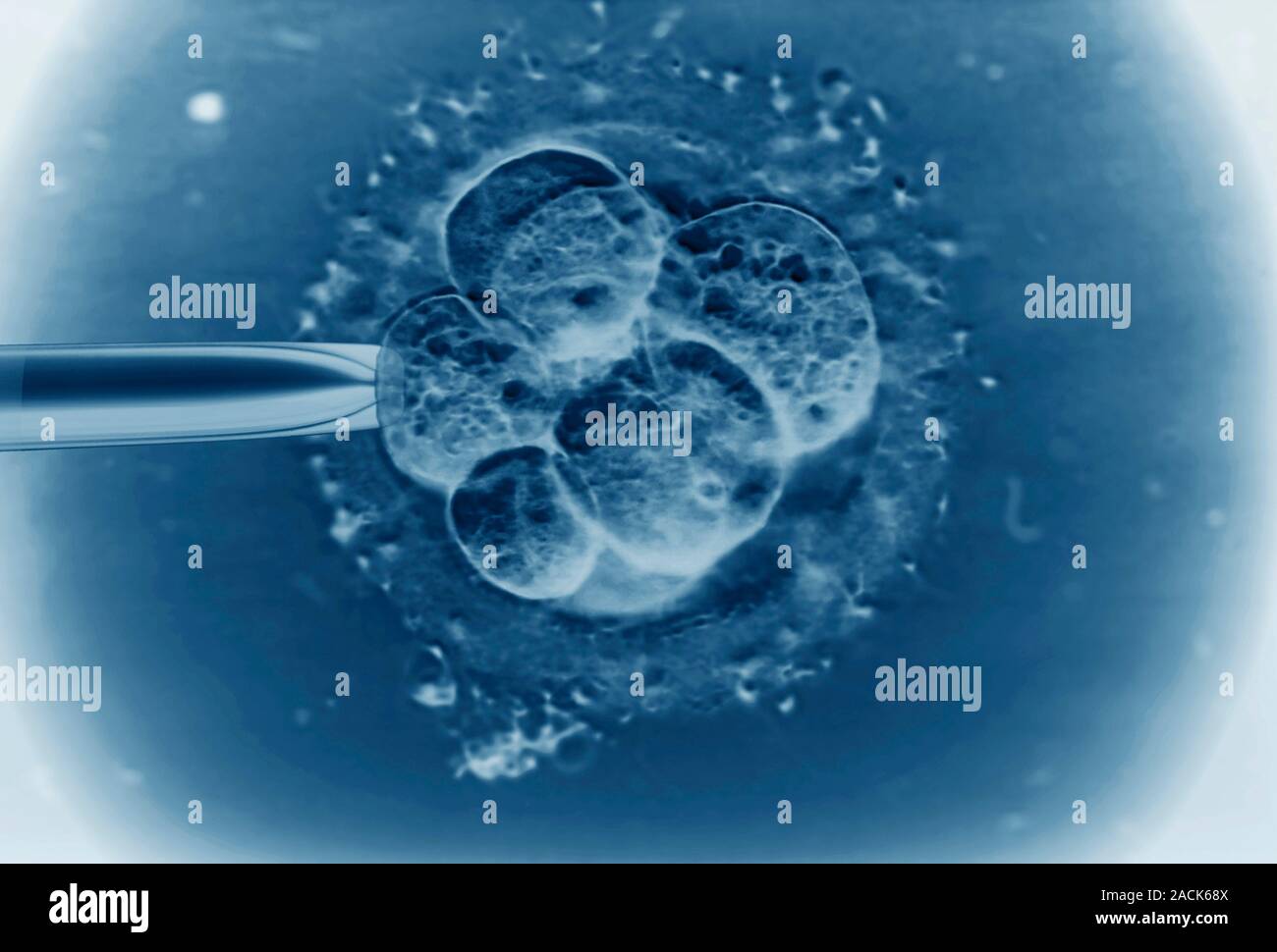 IVF embryo. Coloured light micrograph of a human embryo 48-72 hours ...