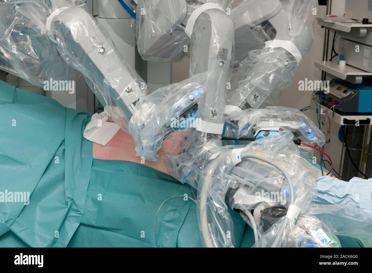 Robotic surgery. Da Vinci robot surgeon operating on a patient. This ...