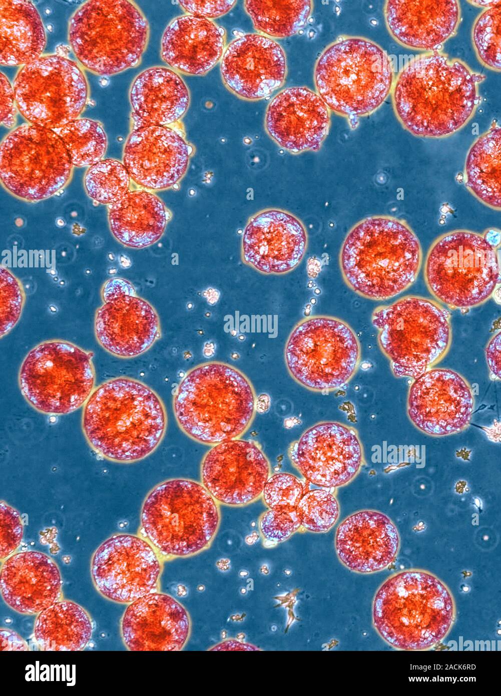 Stem cells, coloured light micrograph. Stem cells are precursor cells ...