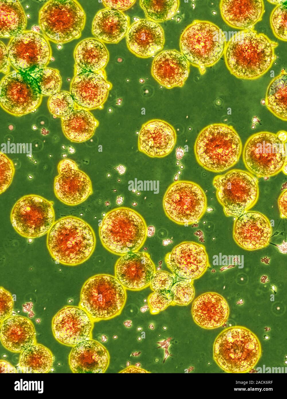 Stem cells, coloured light micrograph. Stem cells are precursor cells ...