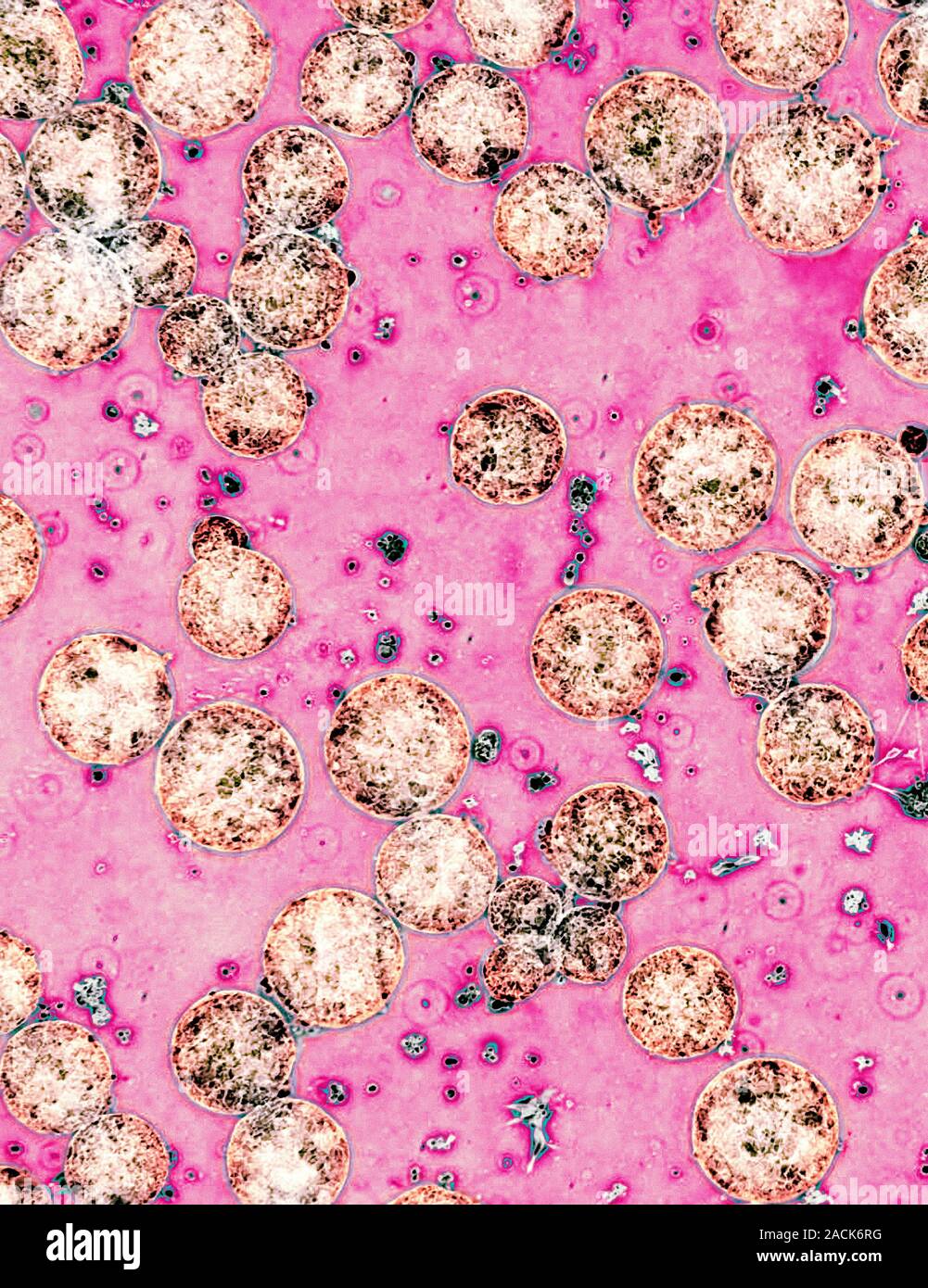 Stem cells, coloured light micrograph. Stem cells are precursor cells ...