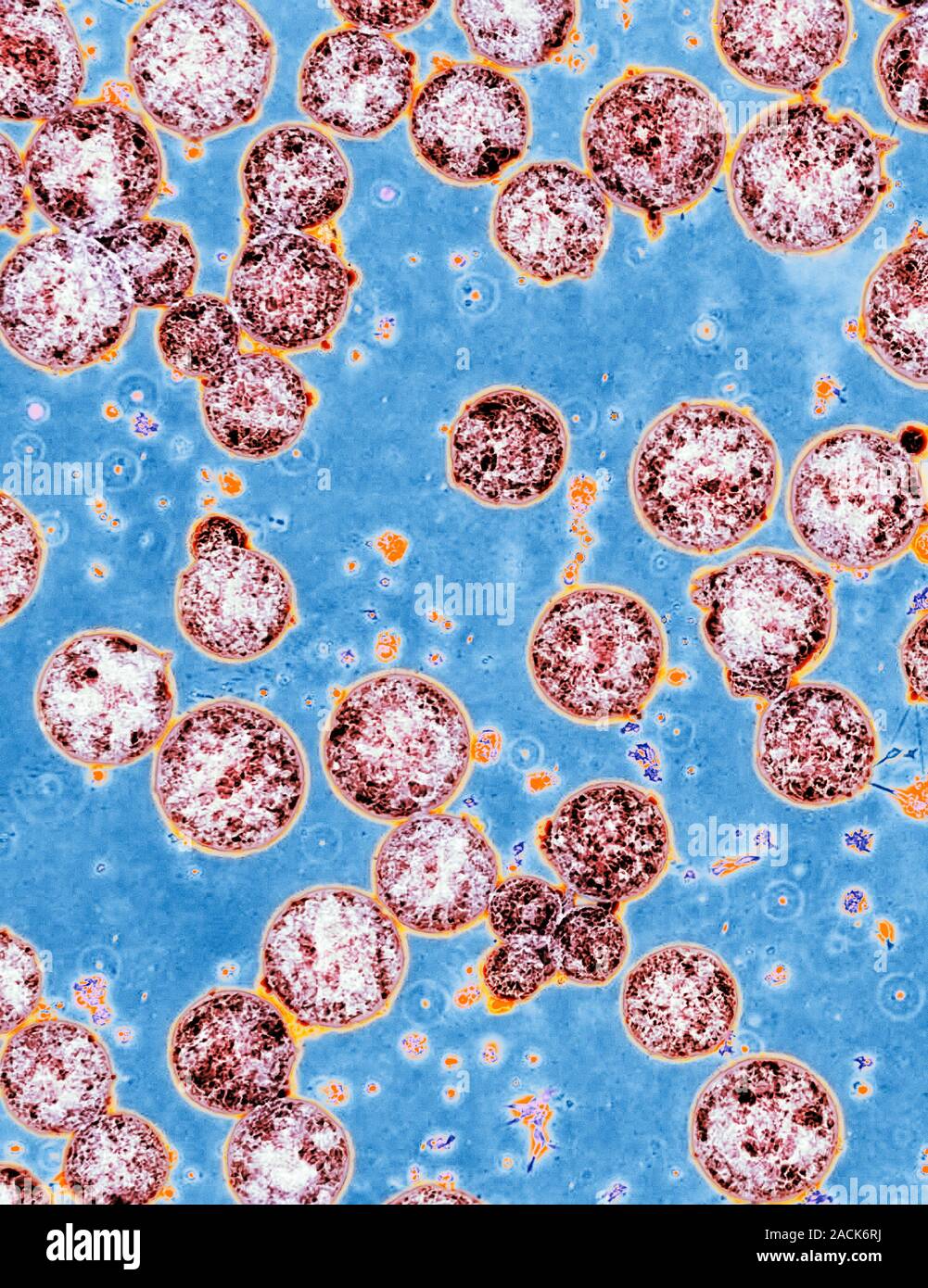 Stem cells, coloured light micrograph. Stem cells are precursor cells ...