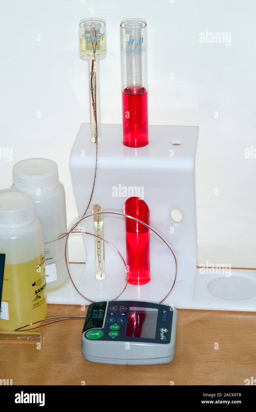 Oesophageal manometry and pH testing equipment. The former allows the ...