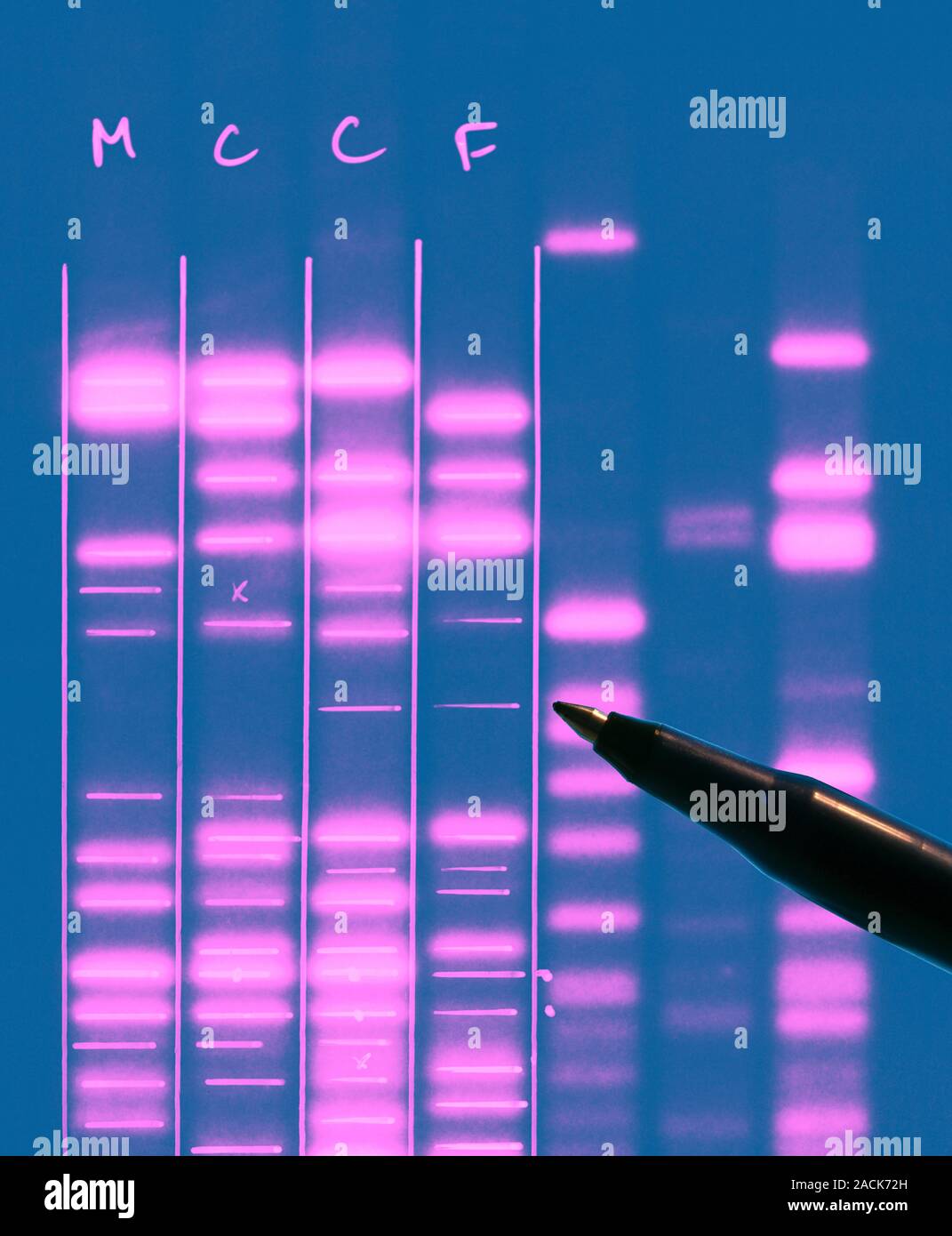 Part of an X-ray (or autoradiograph) of bands of DNA produced by the ...