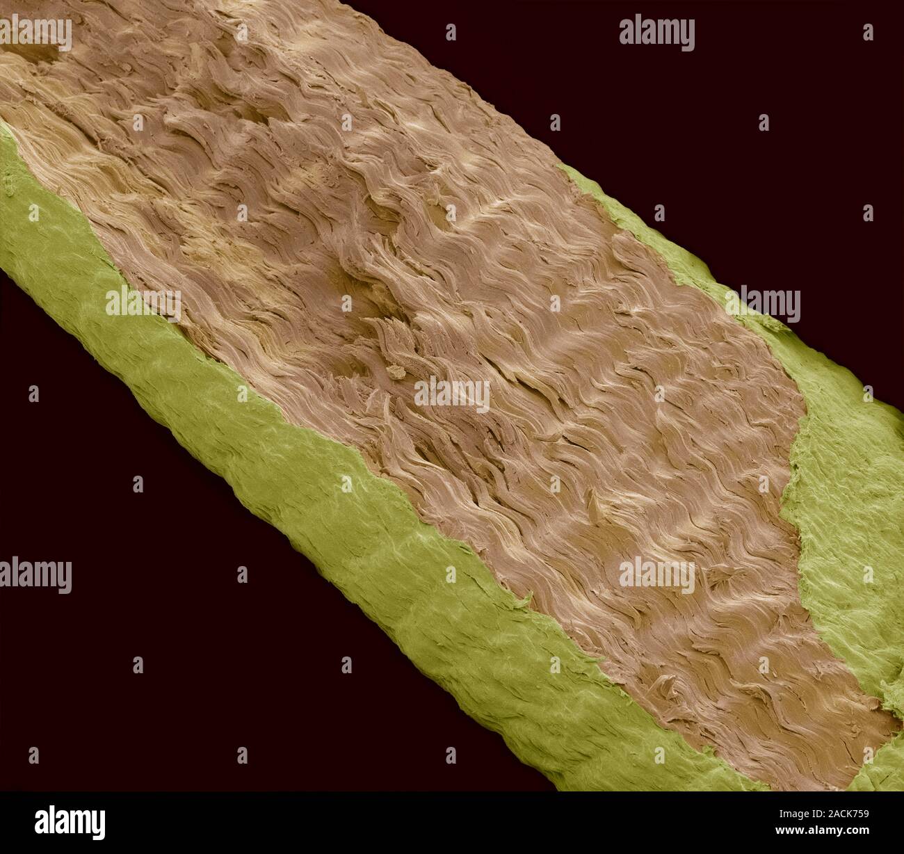 Primate hand tendon. Coloured freeze-fracture scanning electron ... Primate hand tendon. Coloured freeze-fracture scanning electron ...
