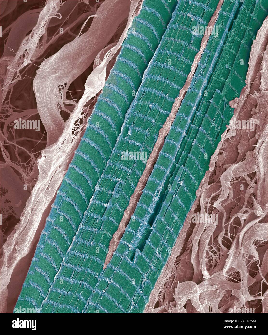 Primate finger muscle. Coloured freeze-fracture scanning electron micrograph (SEM) of striated ...