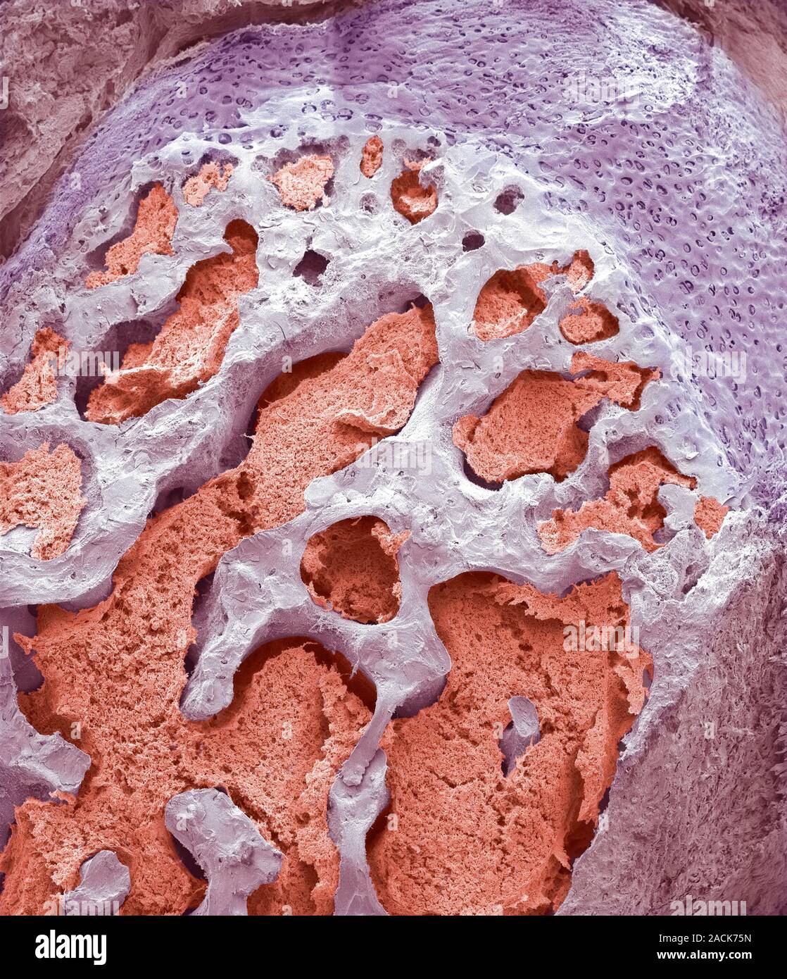 Primate finger bone. Coloured freeze-fracture scanning electron ...