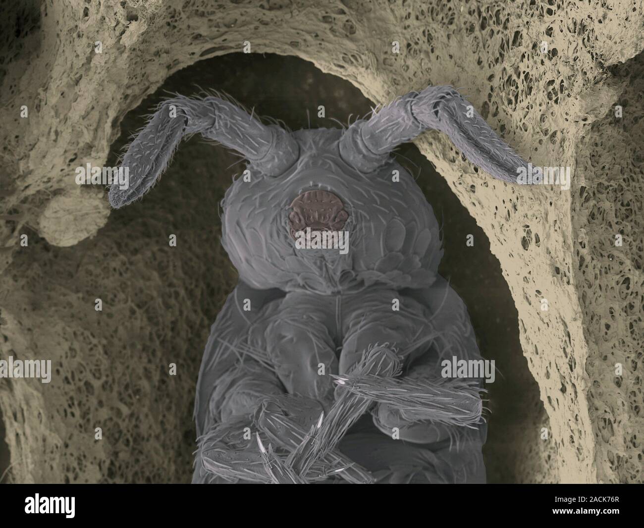 Springtail, coloured scanning electron micrograph (SEM). This arthropod ...
