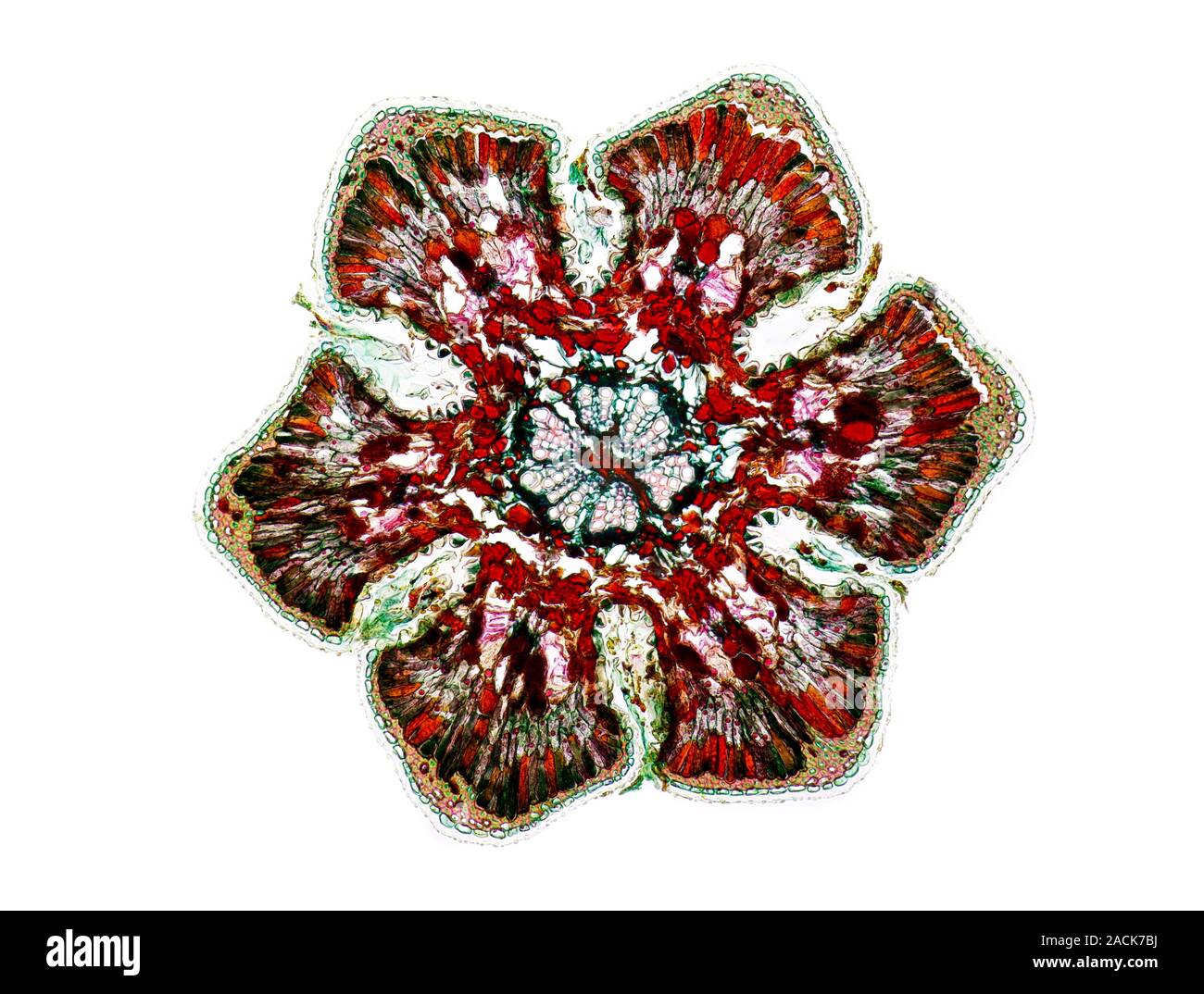 Casuarinacone sp. fruit. Light micrograph of a transverse section ...