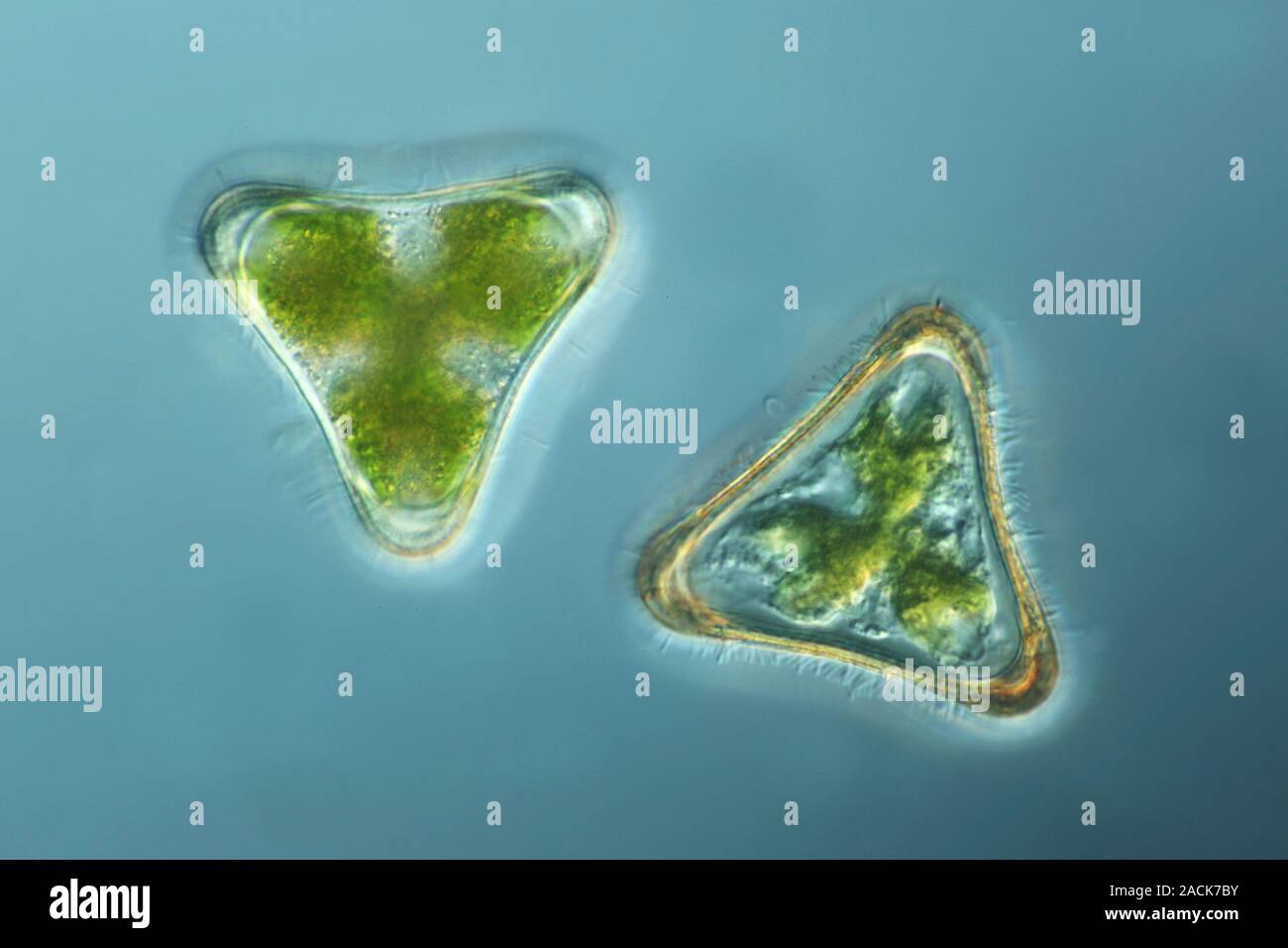 Green algae. Light micrograph of the desmid green algae Desmidium ...