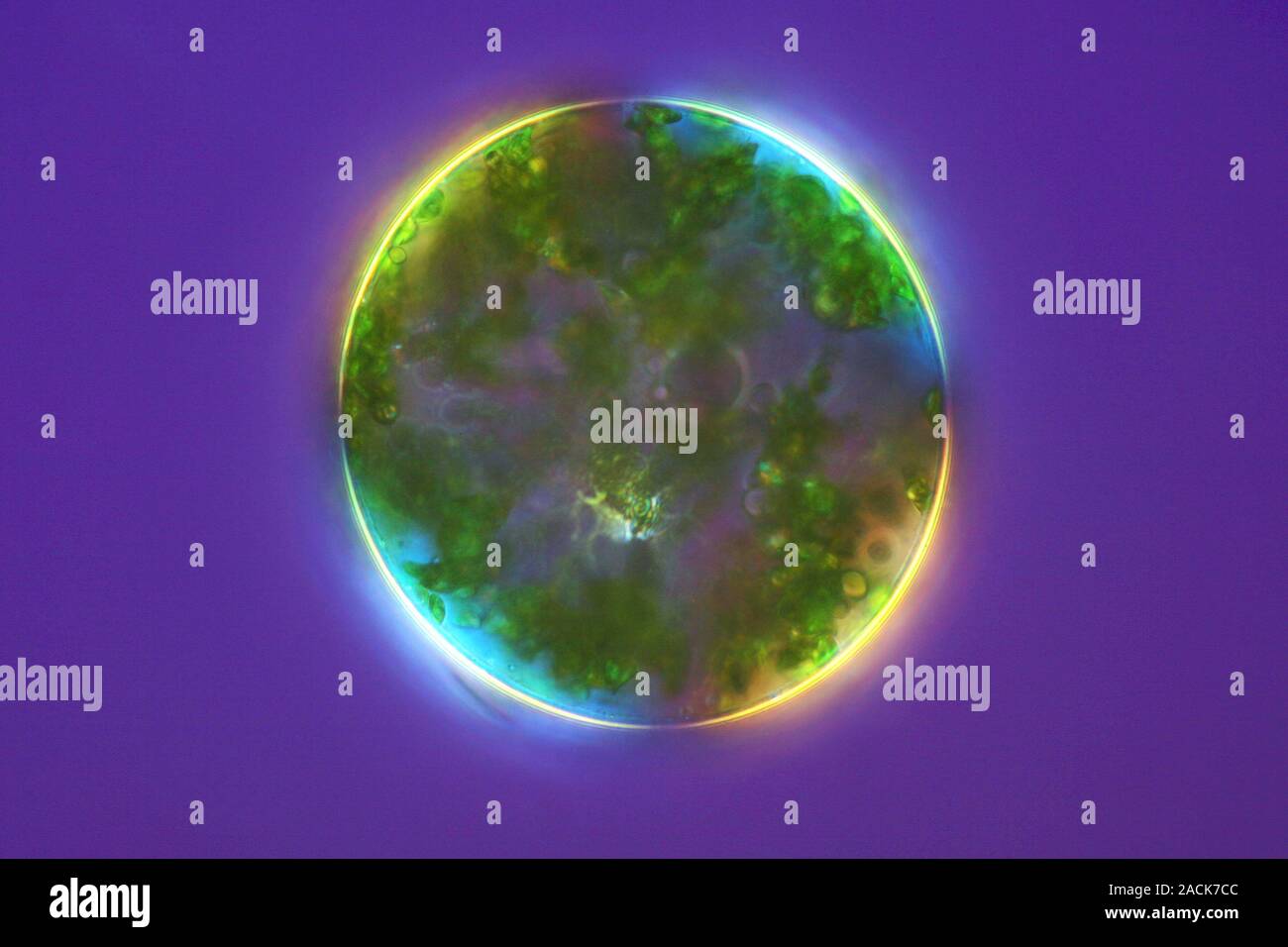 Green algae. Light micrograph of an Eremosphaera viridis green alga ...