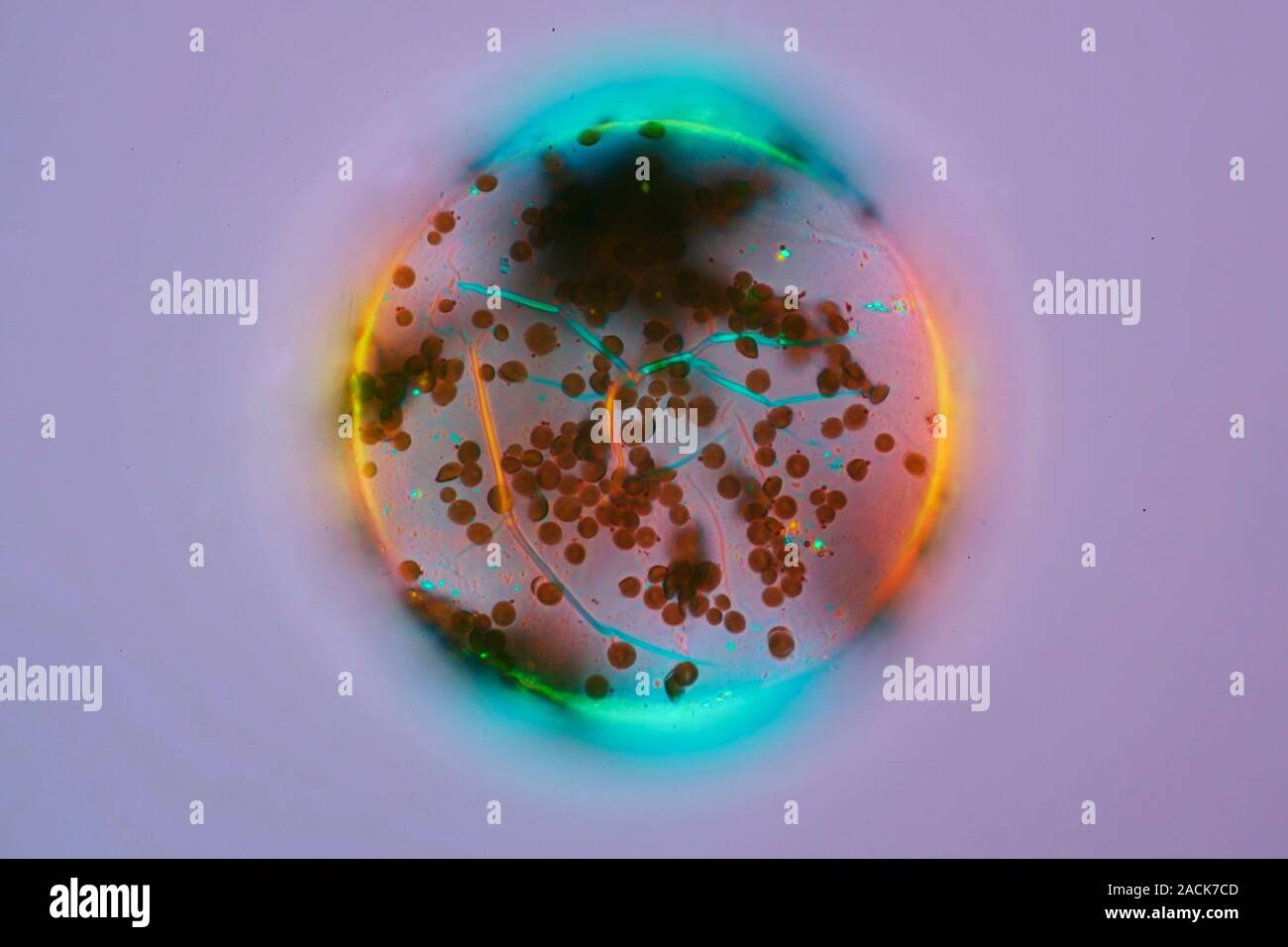 Green algae. Light micrograph of an Eremosphaera viridis green alga ...