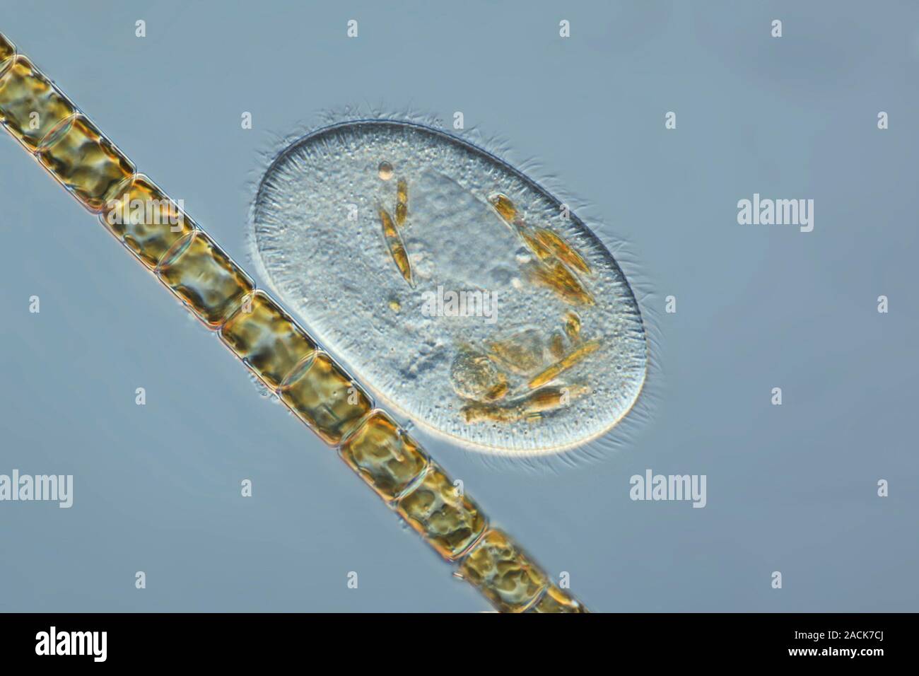 Frontonia protozoan. Light micrograph of a Frontonia sp. ciliate ...