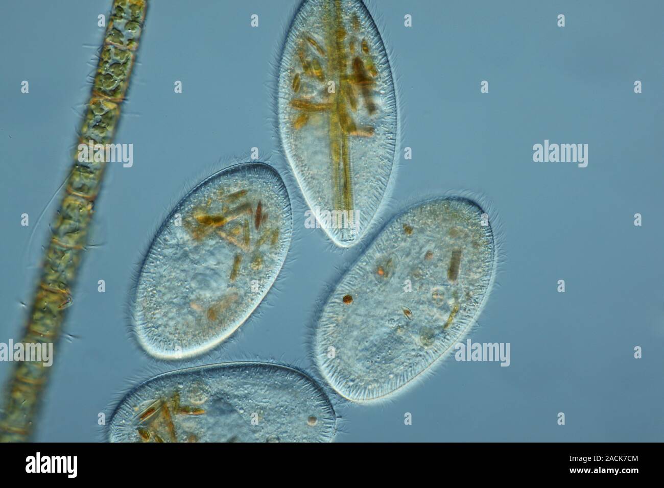 Frontonia protozoa. Light micrograph of a group of Frontonia sp ...