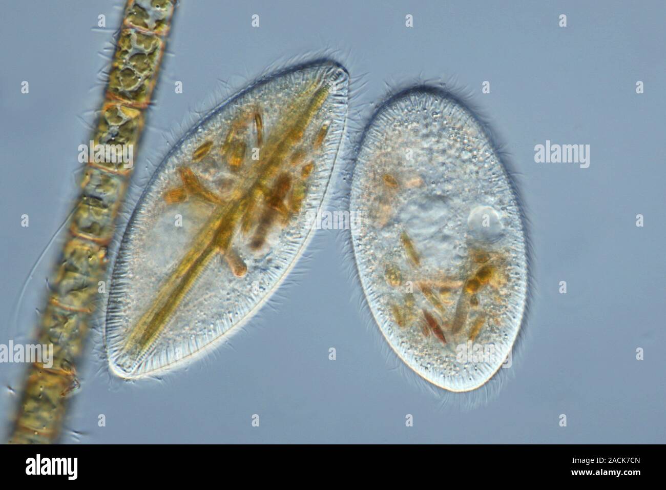 Frontonia protozoa. Light micrograph of a group of Frontonia sp ...