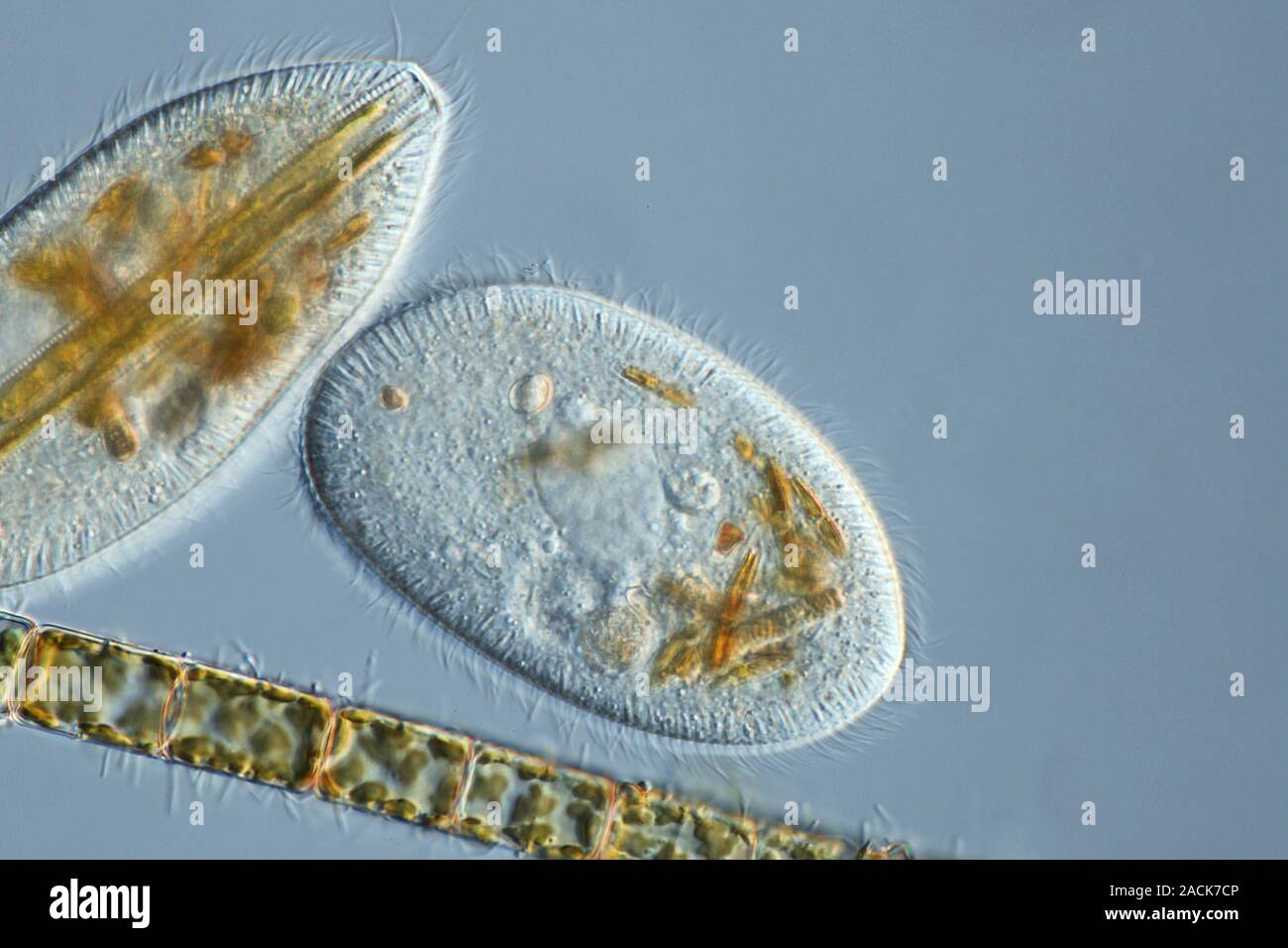 Frontonia protozoa. Light micrograph of a group of Frontonia sp ...