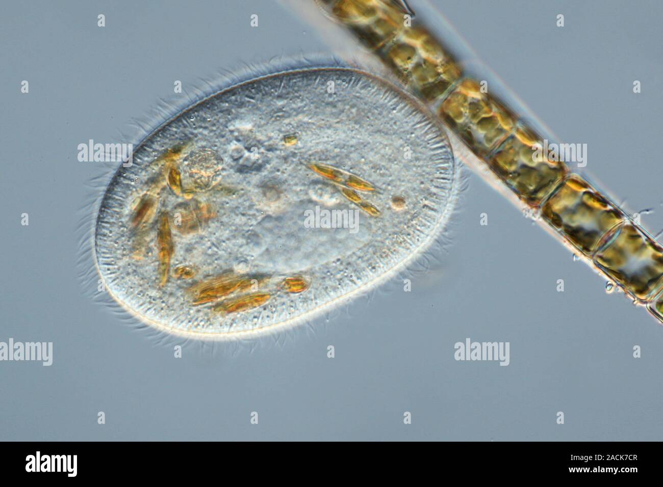 Frontonia protozoan. Light micrograph of a Frontonia sp. ciliate ...