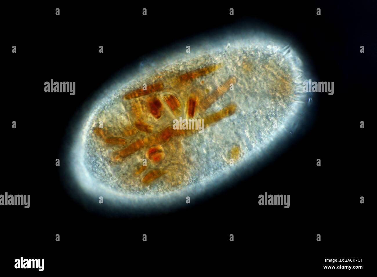 Frontonia protozoan. Light micrograph of a Frontonia sp. ciliate ...