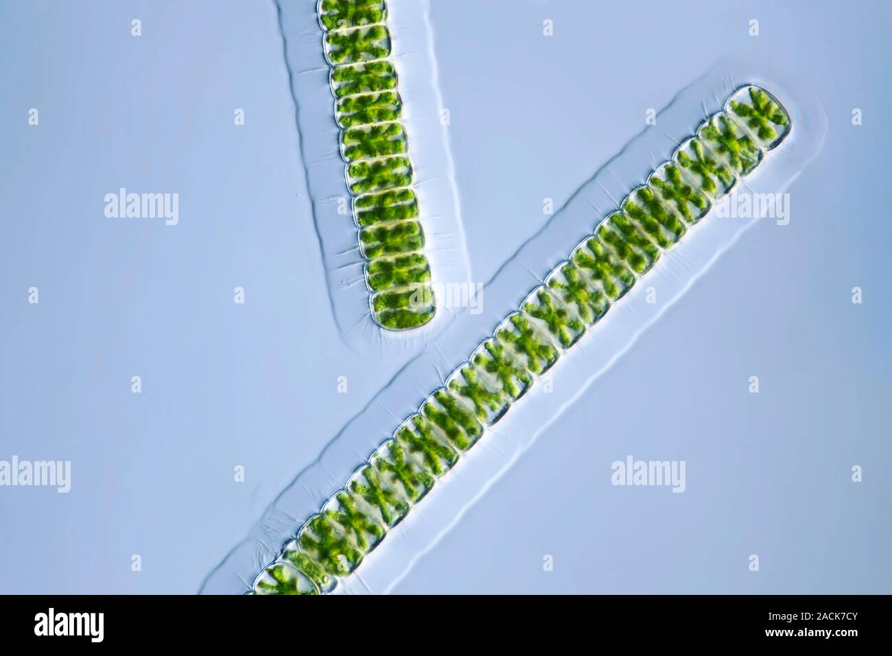 Green algae. Light micrograph of the desmid green algae Hyalotheca ...