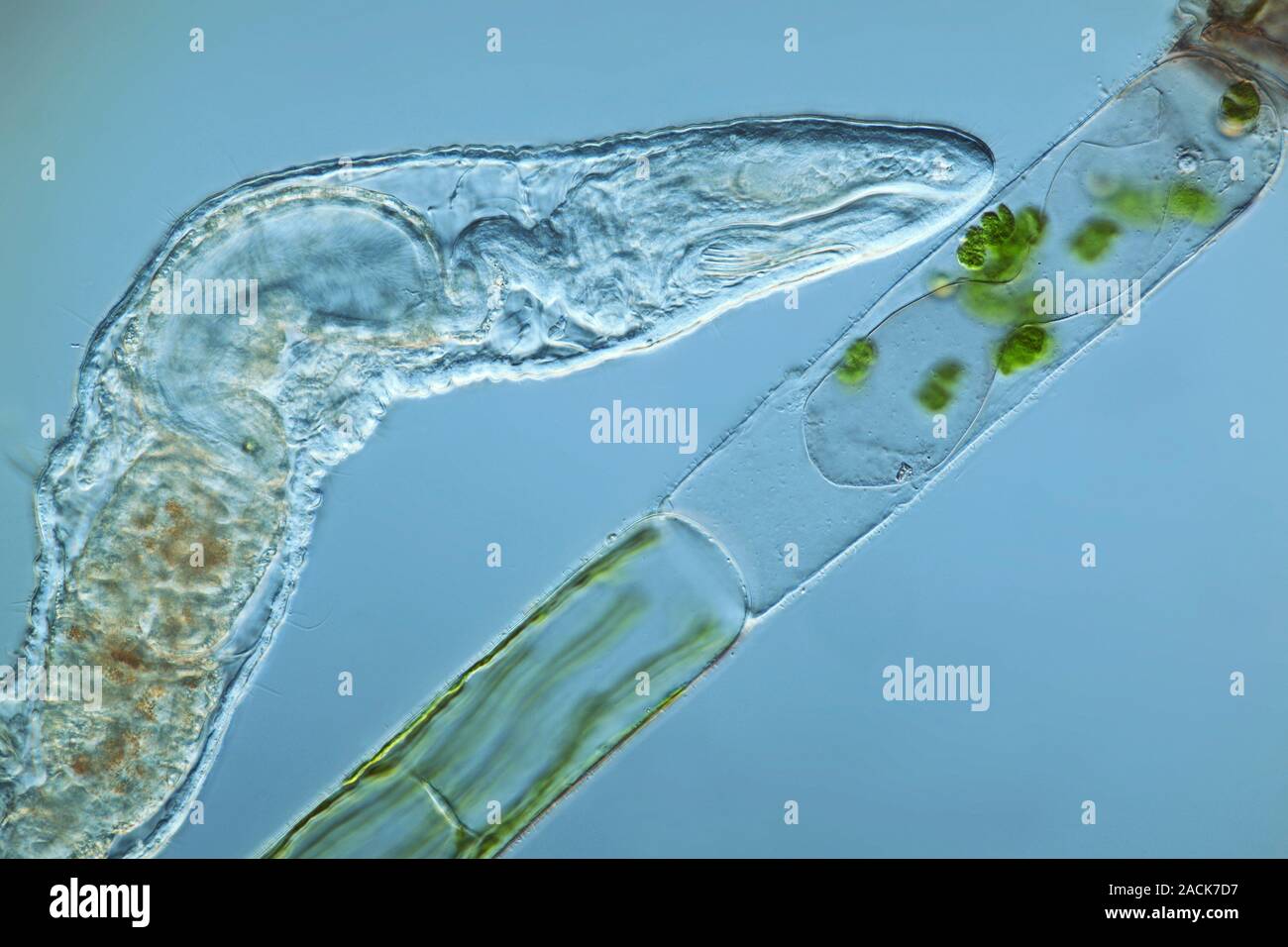 Worm feeding on algae. Light micrograph of an microscopic annelid worm (subclass Oligochaeta ...