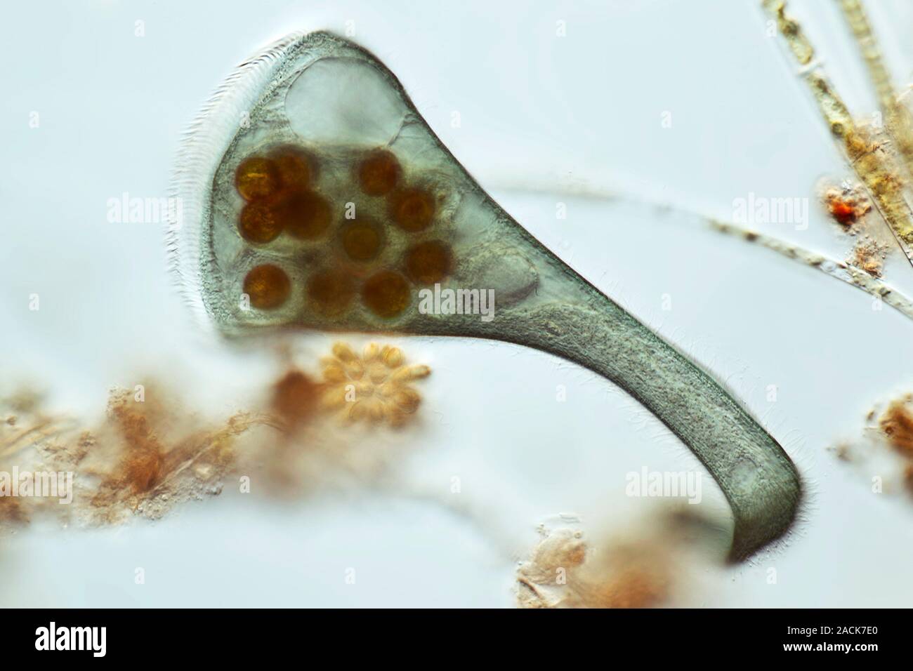 Stentor coeruleus protozoan. Light micrograph of Stentor coeruleus ...