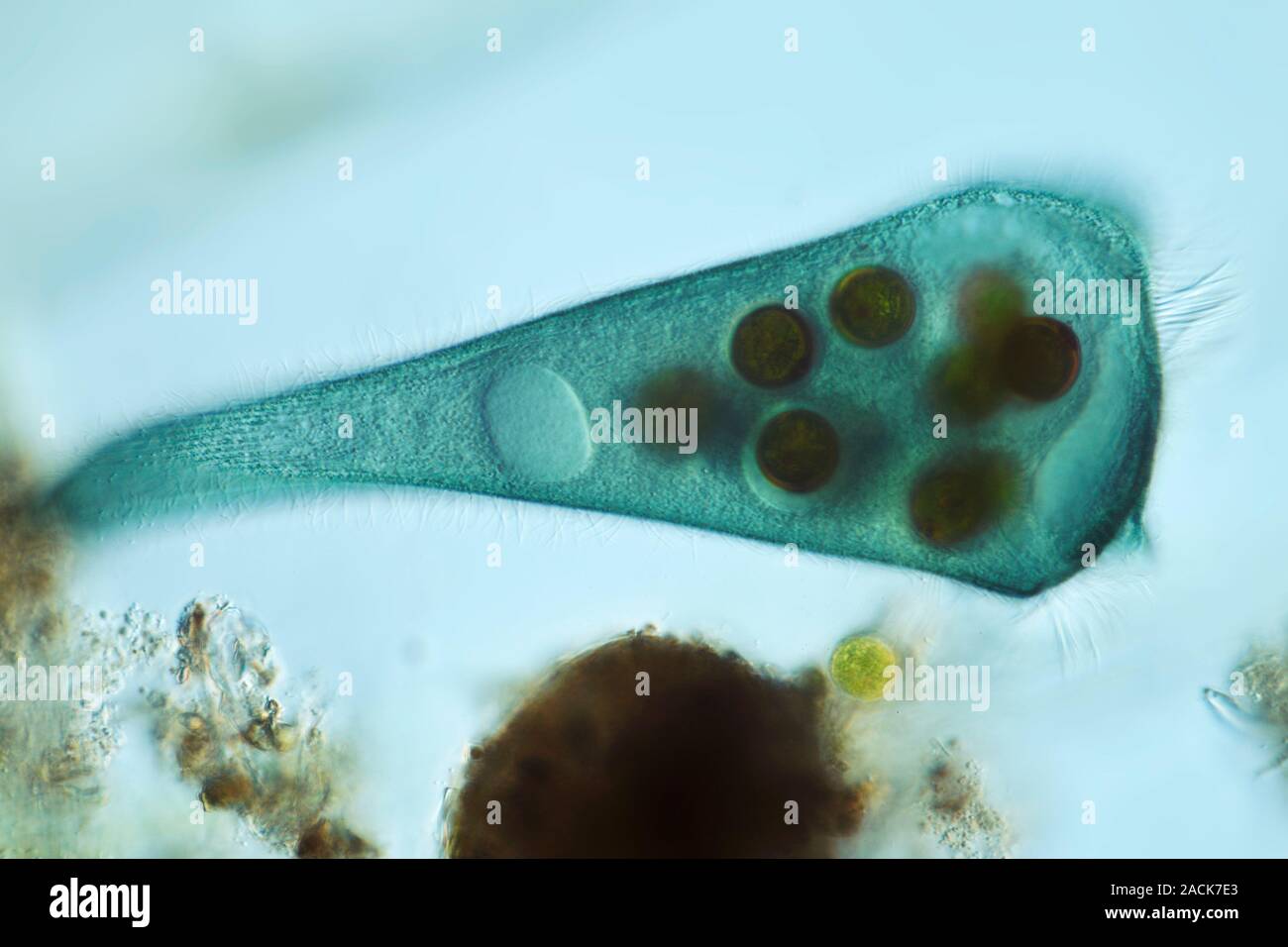 Stentor coeruleus protozoan. Light micrograph of Stentor coeruleus ...
