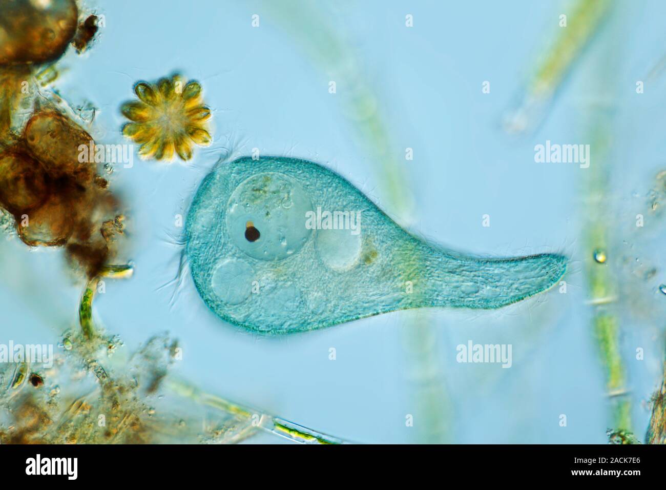 Stentor coeruleus protozoan. Light micrograph of Stentor coeruleus ...