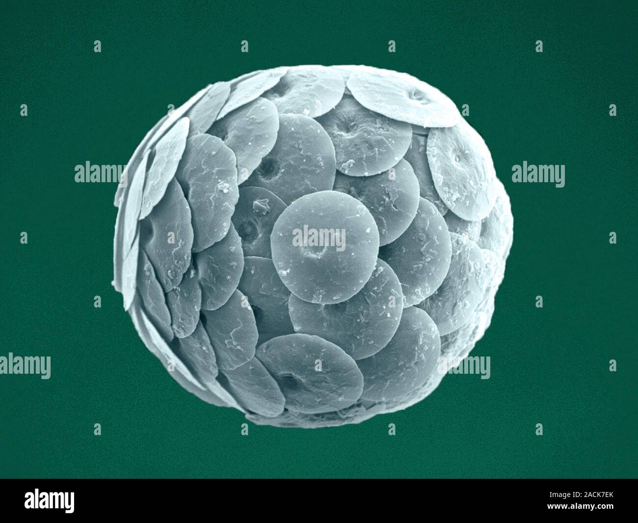 Coccolithophore shell. Coloured scanning electron micrograph (SEM) of ...