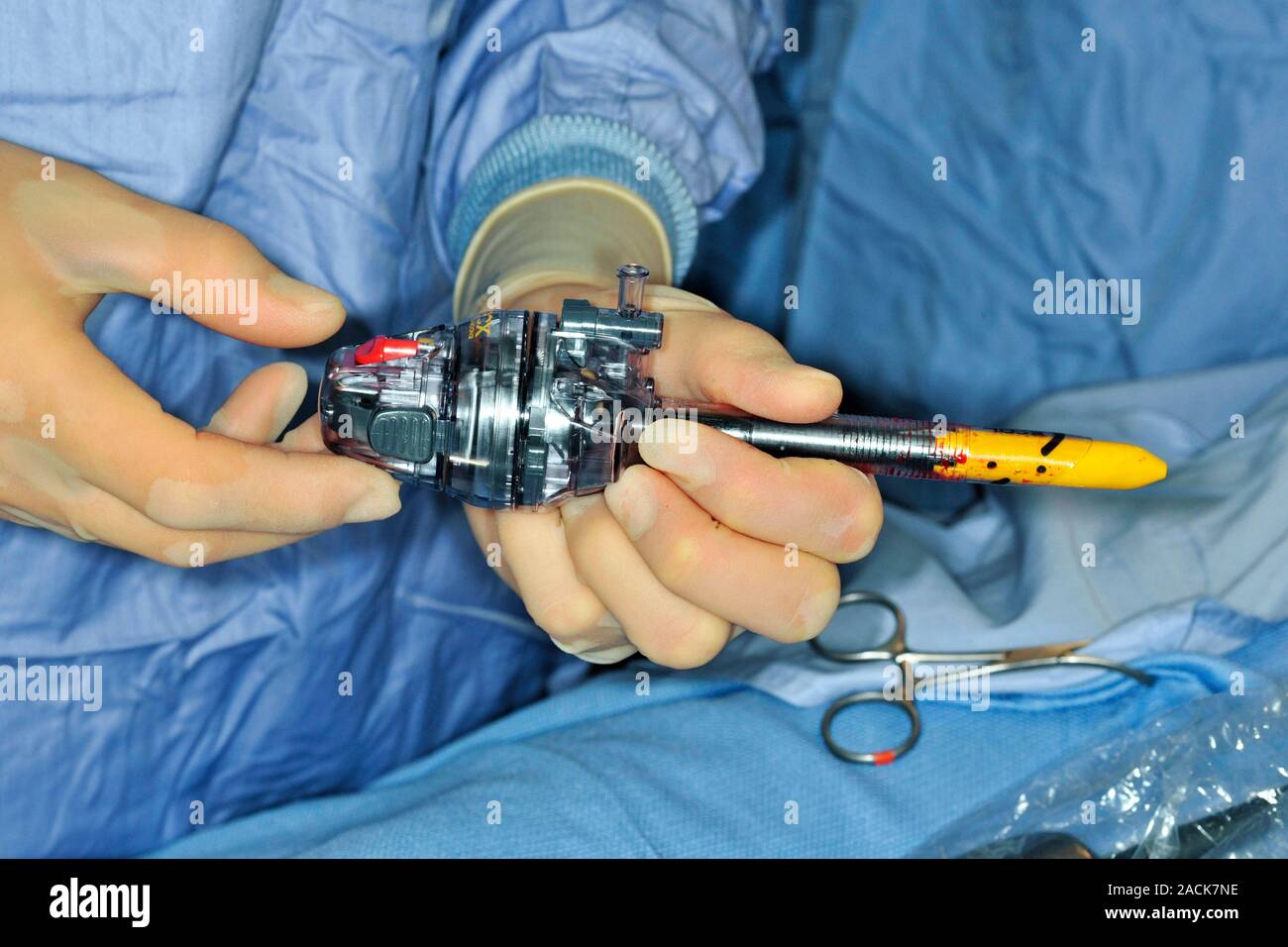 Keyhole surgery instrument. Surgeon holding a trochar fitted with a ...