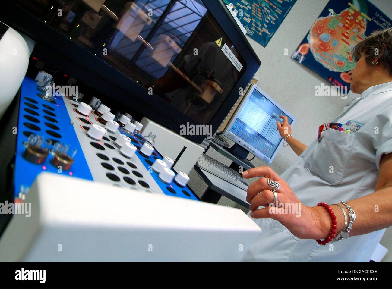 Haematology lab. Technician working with blood samples in a haematology ...