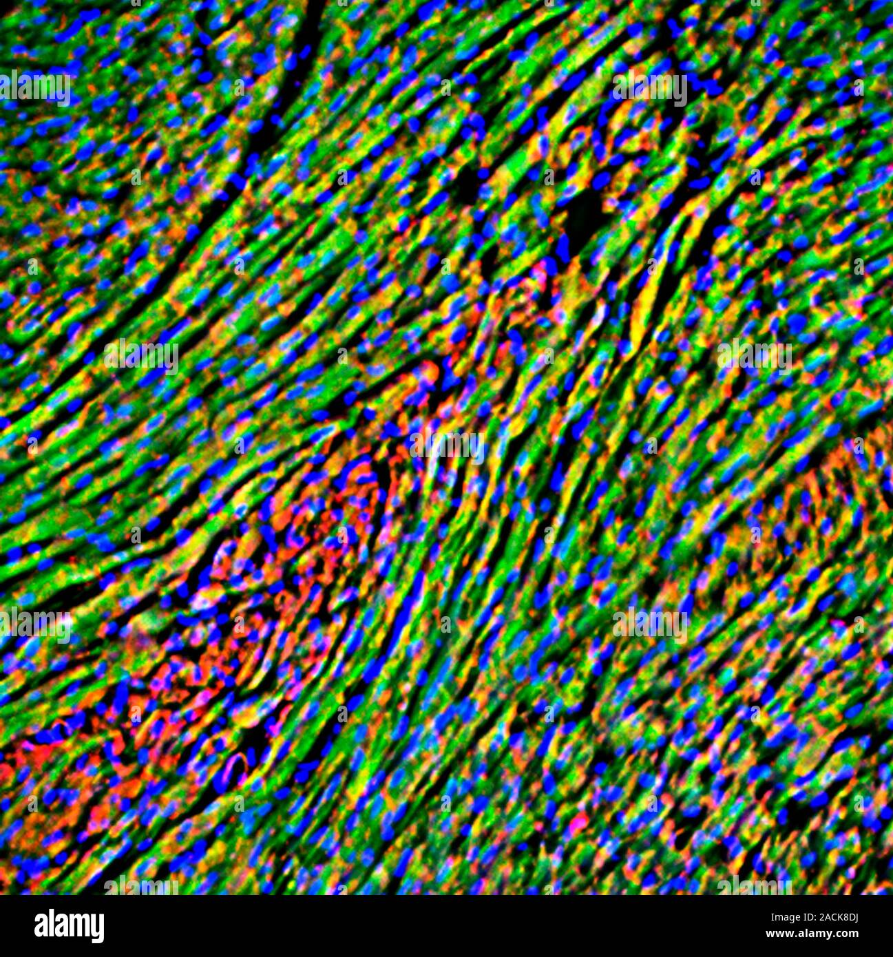 Heart tissue. Fluorescence deconvolution micrograph of a section ...