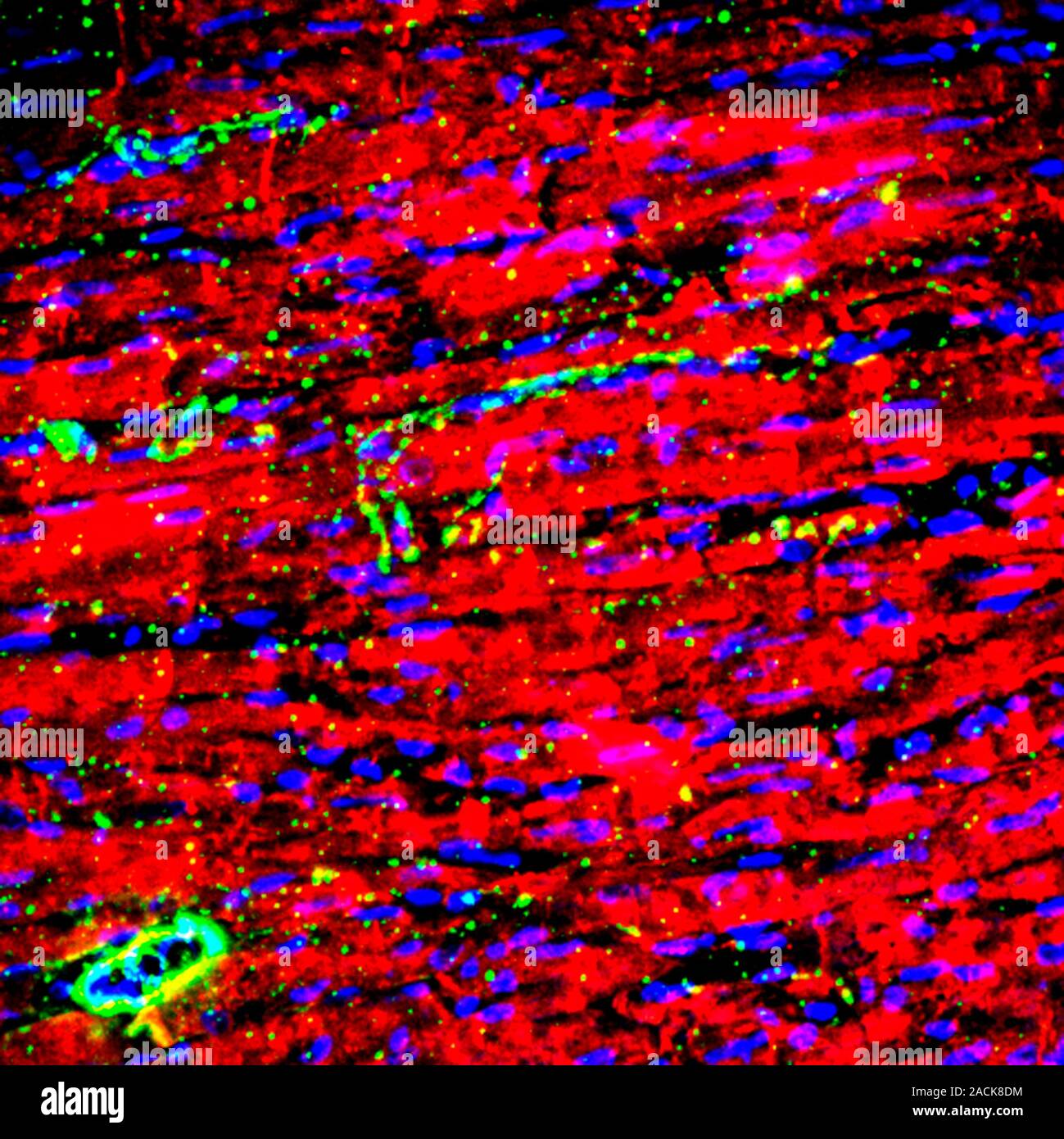 Heart tissue. Fluorescence deconvolution micrograph of a section ...
