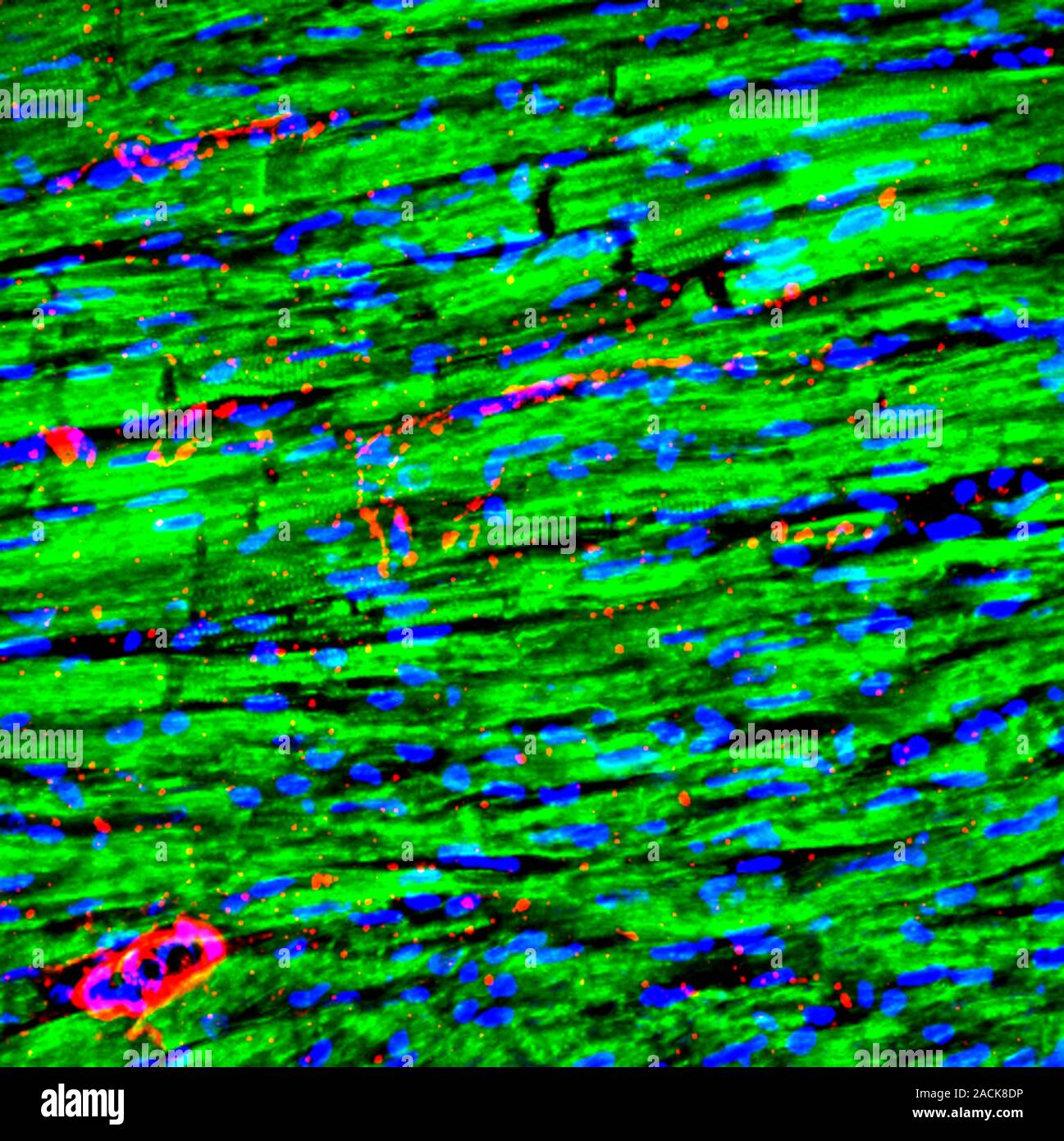 Heart tissue. Fluorescence deconvolution micrograph of a section ...