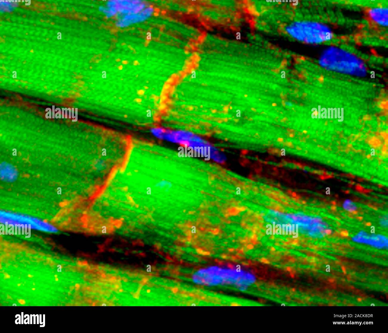 Heart tissue. Fluorescence deconvolution micrograph of a section ...